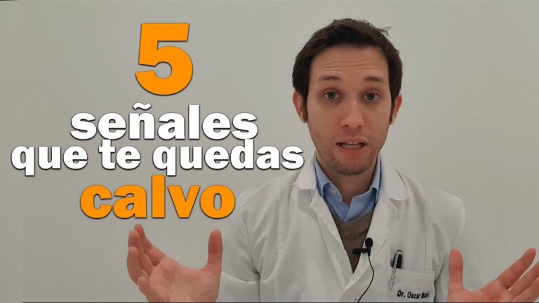 Cómo detectar si estás destinado a ser calvo: ¡Descubre las señales que ...